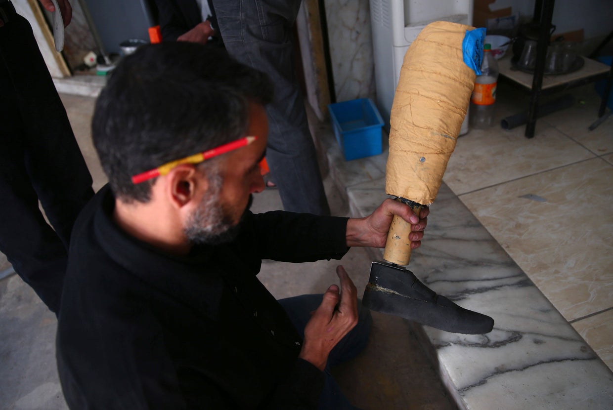 Turning trash into limbs