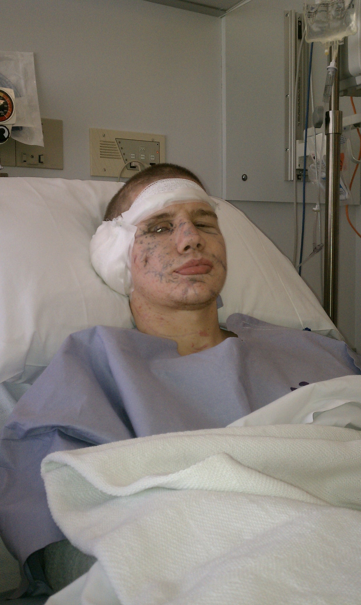 Kyle Carpenter, an American hero