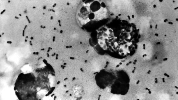 How does plague spread in the U.S.? - CBS News