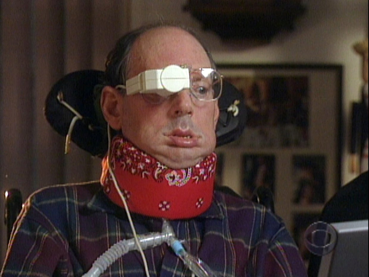 Courageous ALS patients try to live it up - CBS News