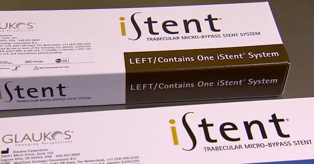 Tiny new iStent medical device helps glaucoma patients see - CBS News