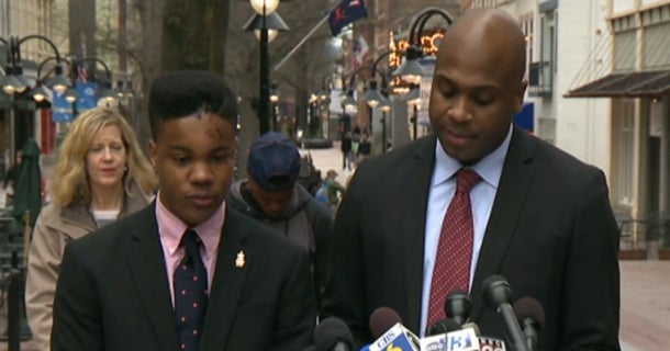 U.Va. student hurt during arrest speaks out: "How could this happen ...