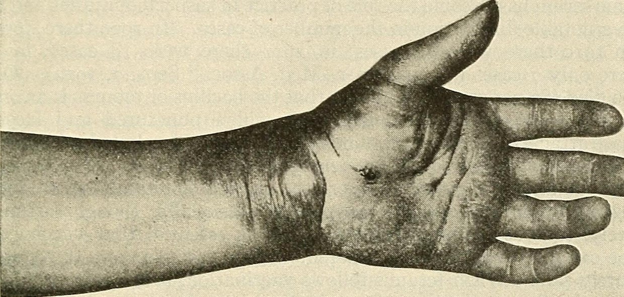 Medieval and ancient medicine we still use