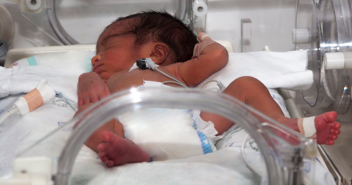 Fracking linked to low birth weight babies - CBS News