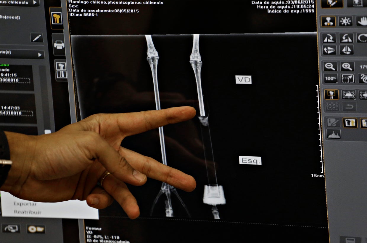 Flamingo amputee gets a new leg to stand on