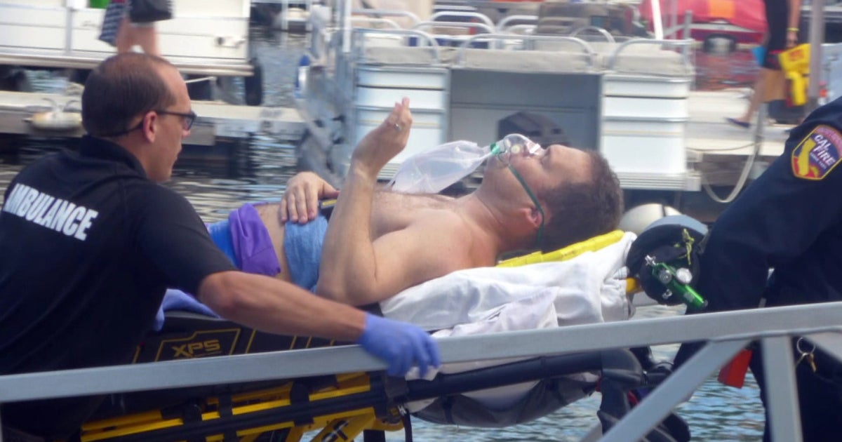 Gravely-injured skydiver saved by "ripcord" in surgery - CBS News