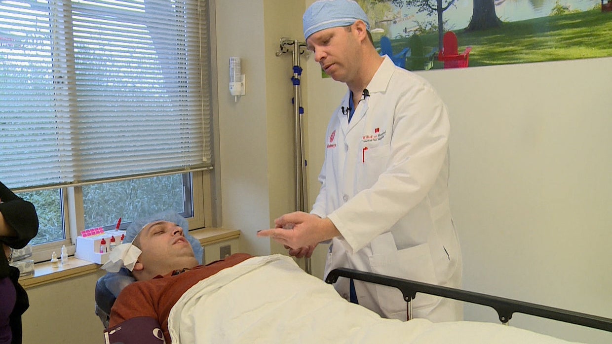 Prosthetic iris gives man new view of the world - CBS News