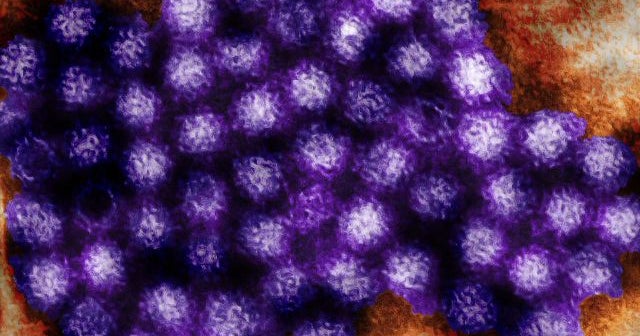 New norovirus strain found amid recent outbreaks as peak season arrives ...