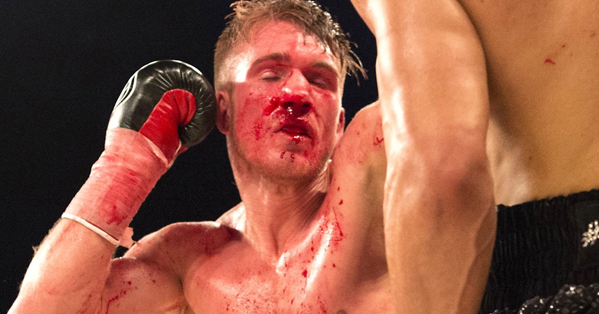 British boxer in coma after title fight loss - CBS News