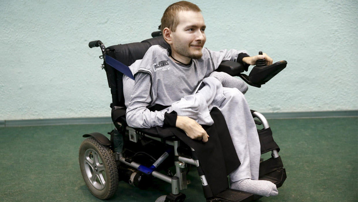 Russian man volunteers for first human head transplant - CBS News