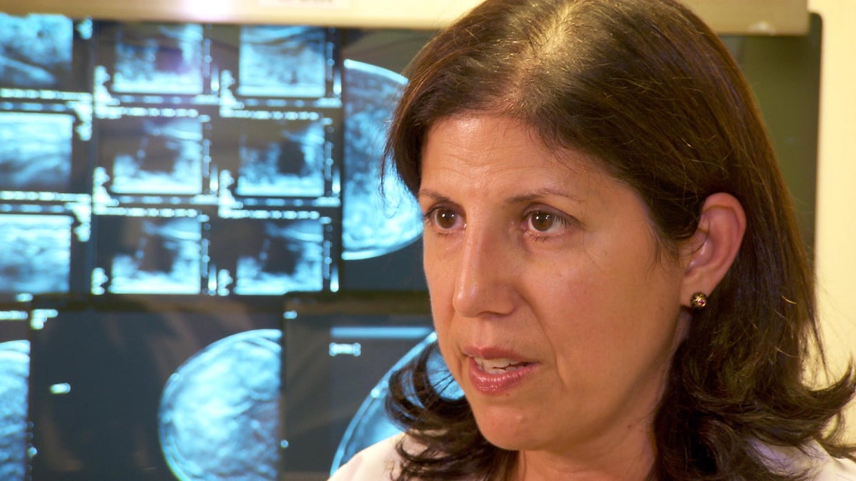 Researchers tackle metastatic breast cancer - CBS News