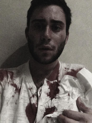 Crime scene photos: NYC sledgehammer attack