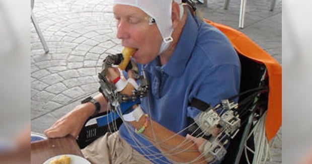 Mind-controlled robotic hand helps paralyzed patients with quadriplegia - CBS News