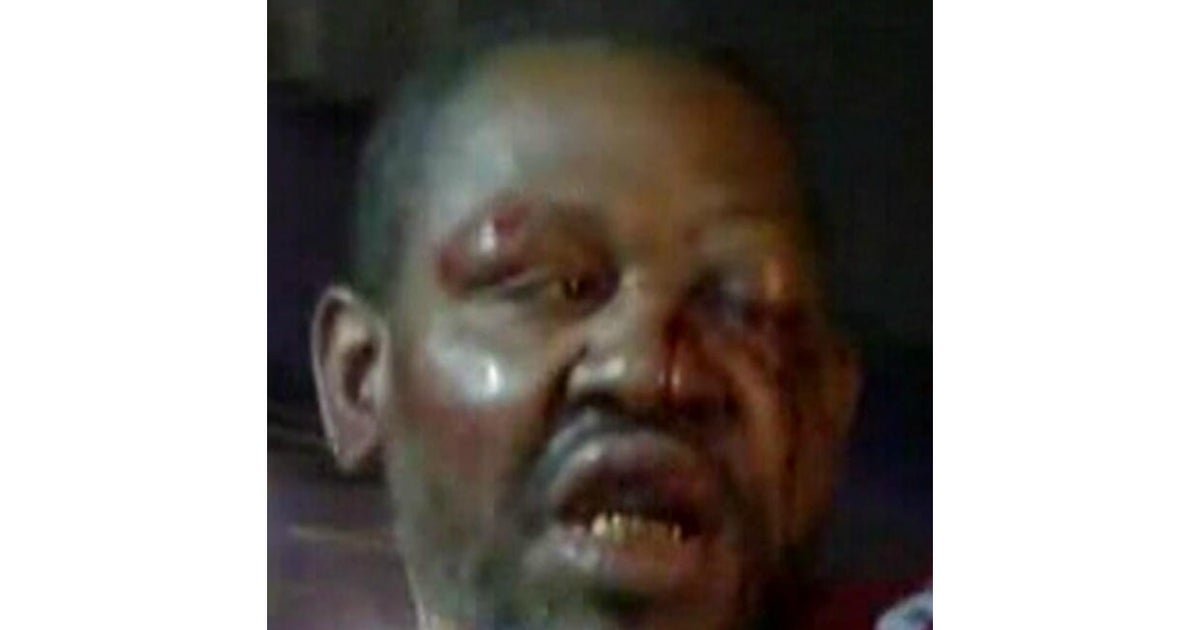 Accused Orlando cop killer Markeith Loyd seen injured, bloody during ...