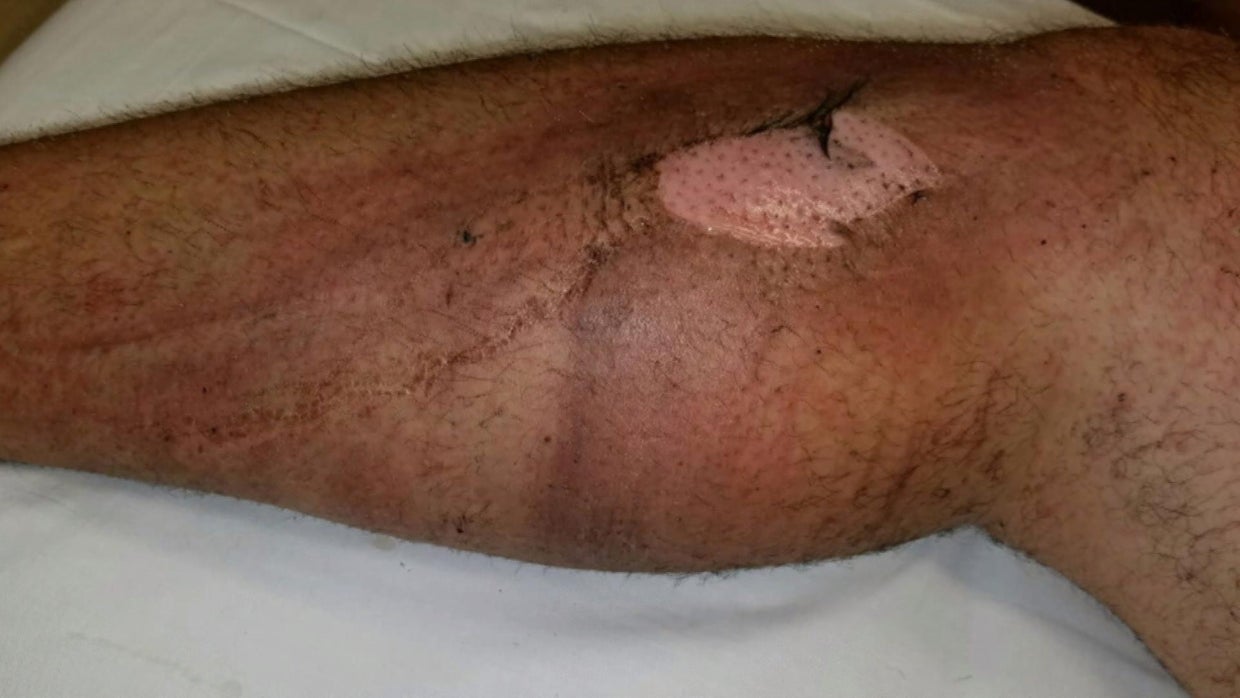 Exploding phone? Samsung's hidden obstacle could prevent lawsuits - CBS ...