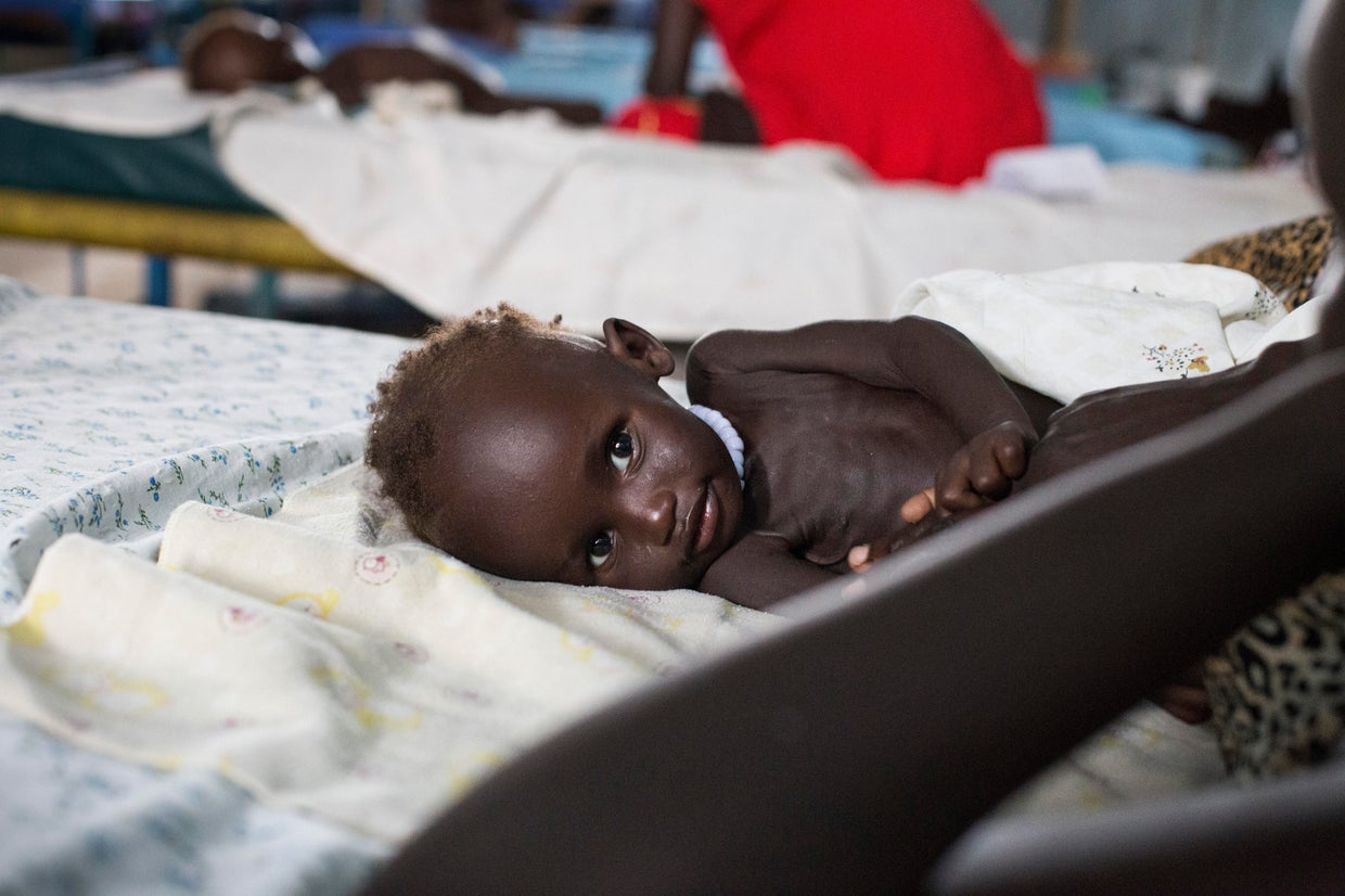 Starving in South Sudan