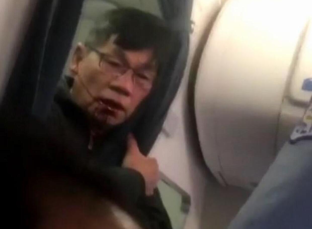 David Dao, United Airlines agree on settlement over dragging incident ...