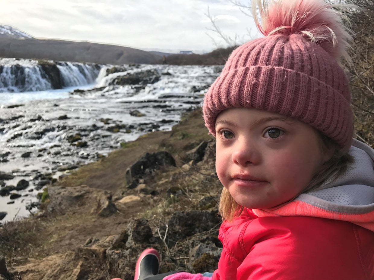 Why Down syndrome in Iceland has almost disappeared - CBS News