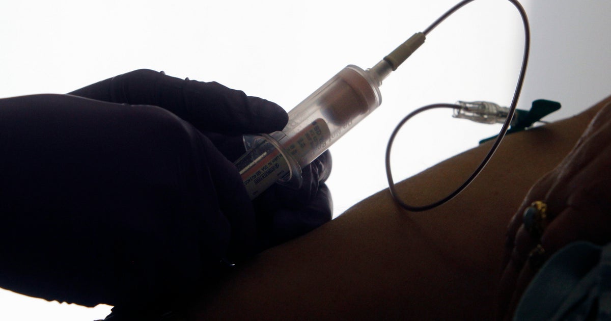 Scientists report progress on "liquid biopsies" for cancer screening ...