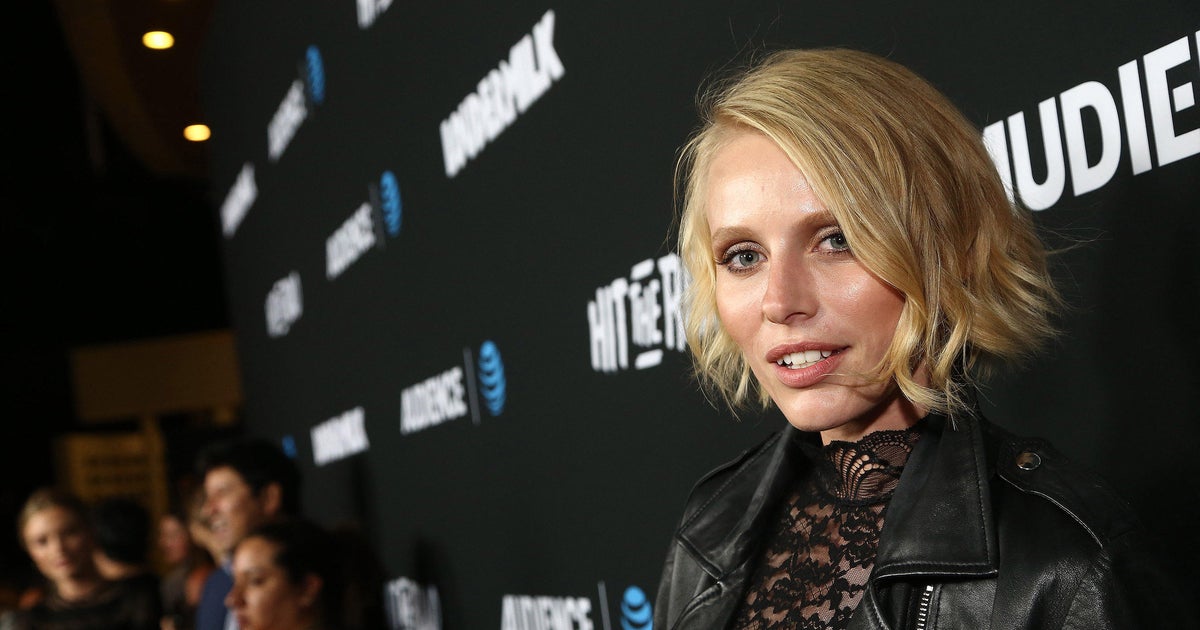 Lauren Wasser, model who lost her leg to TSS, toxic shock syndrome ...