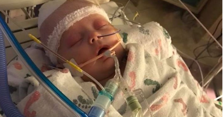 Baby hit by softball treated for fractured skull, brain bleeds - CBS News