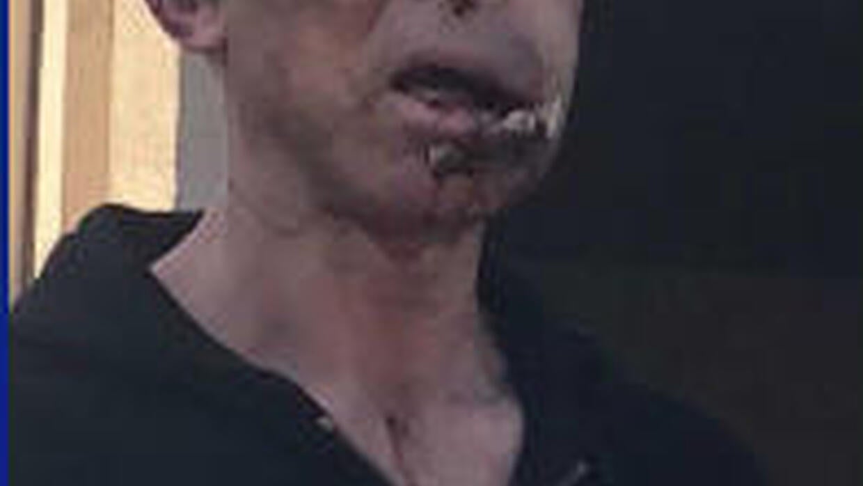 Tom Magee, former pro wrestler, severely beaten in apparent dispute ...