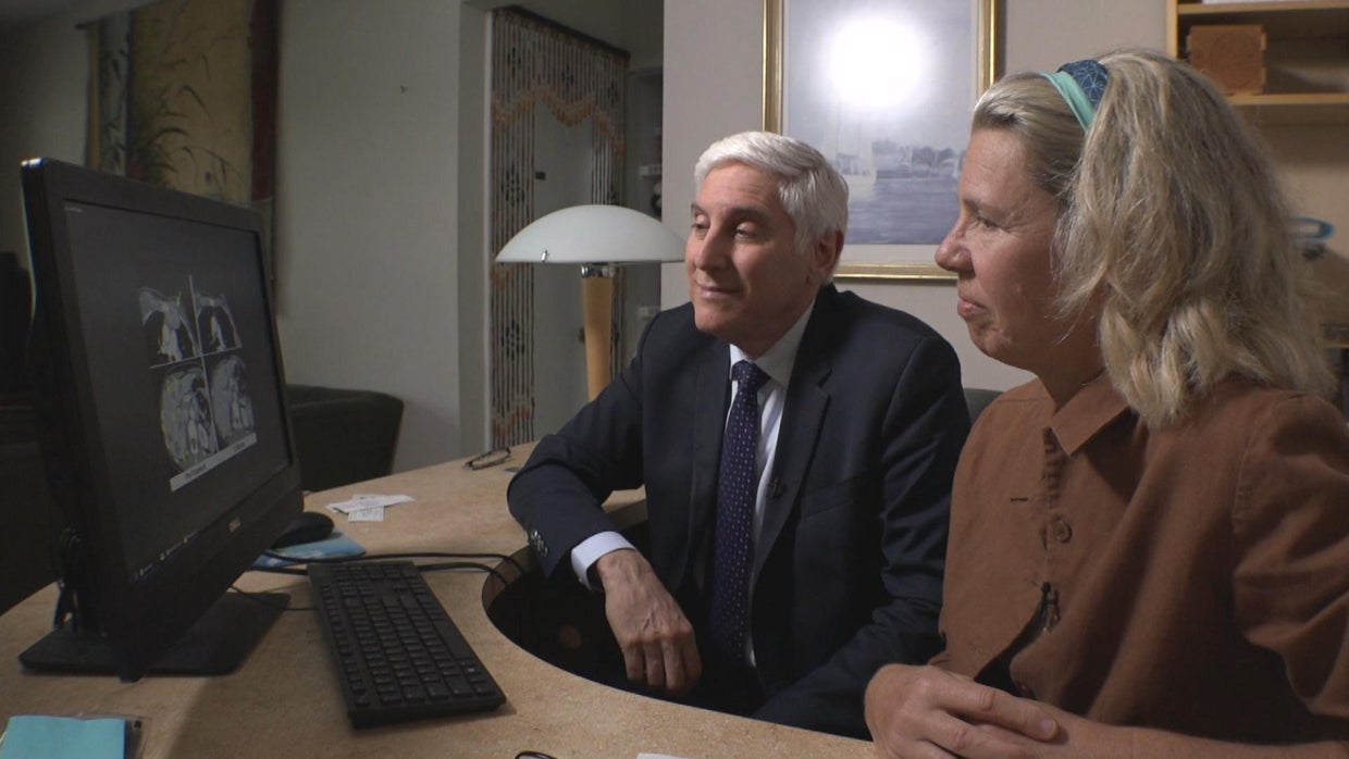 Immunotherapy treatment saves life of woman with late-stage breast ...