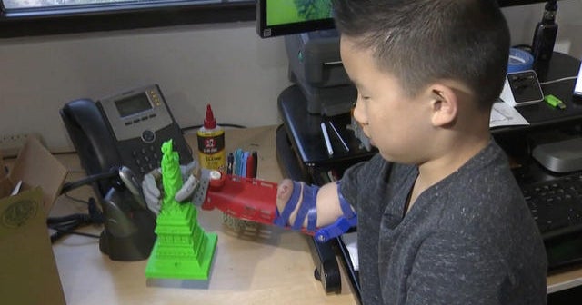 Boy born missing part of right arm gets 3-D printed prostheses - CBS News
