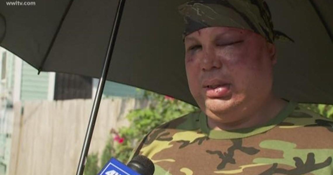 Officers fired, charged after allegedly beating man and calling him ...