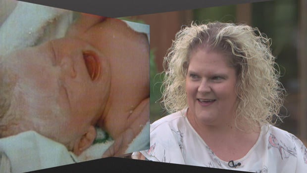 Test tube baby Louise Brown and the birth of IVF - CBS News