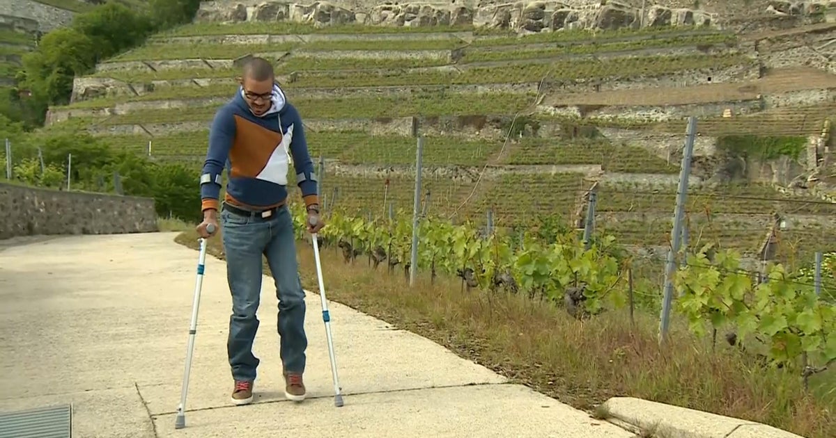 Paralyzed patients walk again with help of spinal implant - CBS News