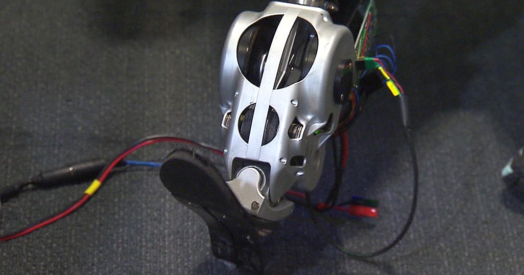 Brain-Controlled Bionic Limbs Developed At MIT - CBS Boston