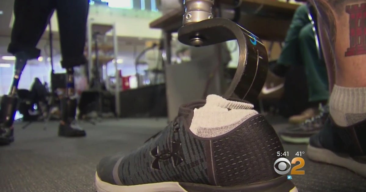 New Ewing Amputation Paves Way For Better Robotic Legs - CBS New York