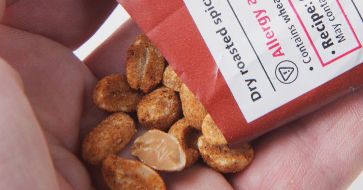 An end to food allergies? A possible answer to severe reactions to ...