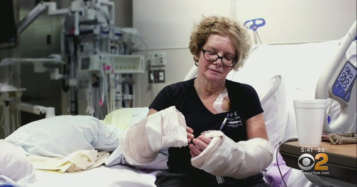 'I'm Here For A Reason': Transplant Patient Reflects After Losing Both ...