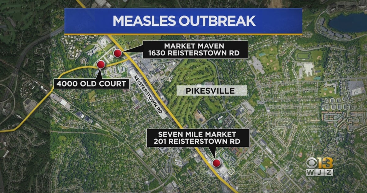 Measles Cases Grow Across U.S., 4 Reported In Maryland - CBS Baltimore