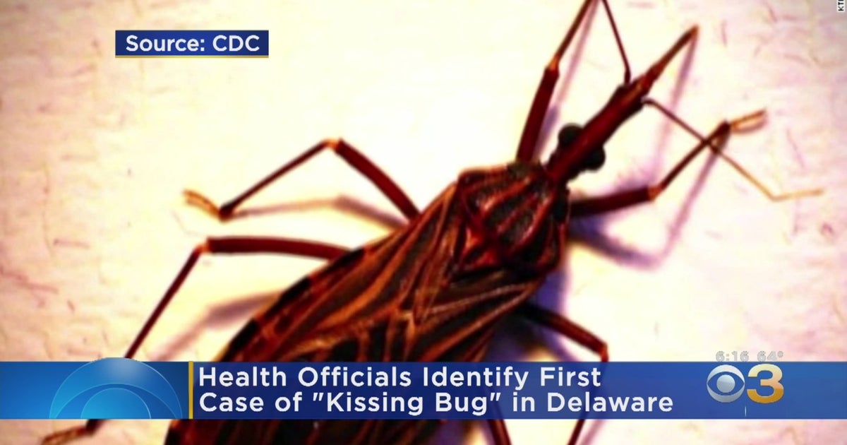 Health Officials Identify First Case Of Blood-Sucking 'Kissing Bug' In ...