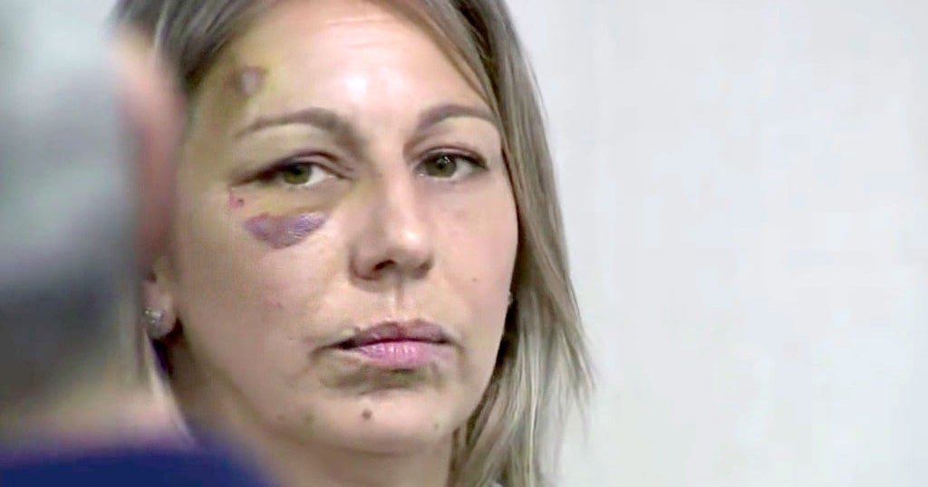 MTA Worker Speaking Out After Another Subway Attack - CBS New York