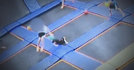 Trampoline Park Injuries Are 'Like Getting Hit With A Hammer ...