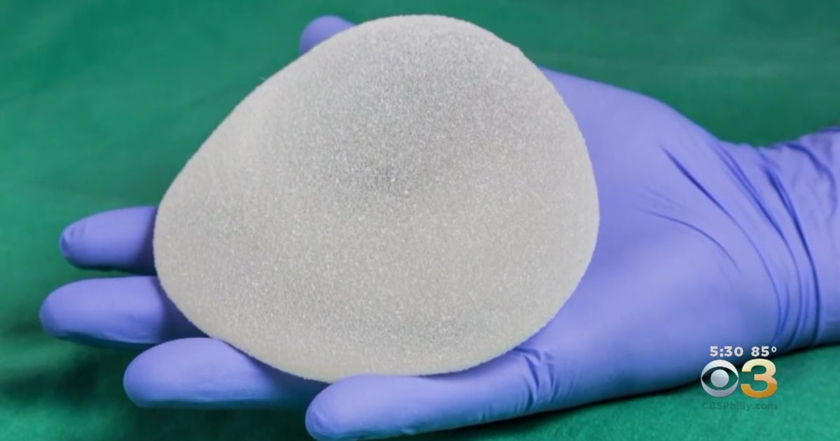 Allergan Recalls Breast Implant Model Linked To Rare And Deadly Form Of ...