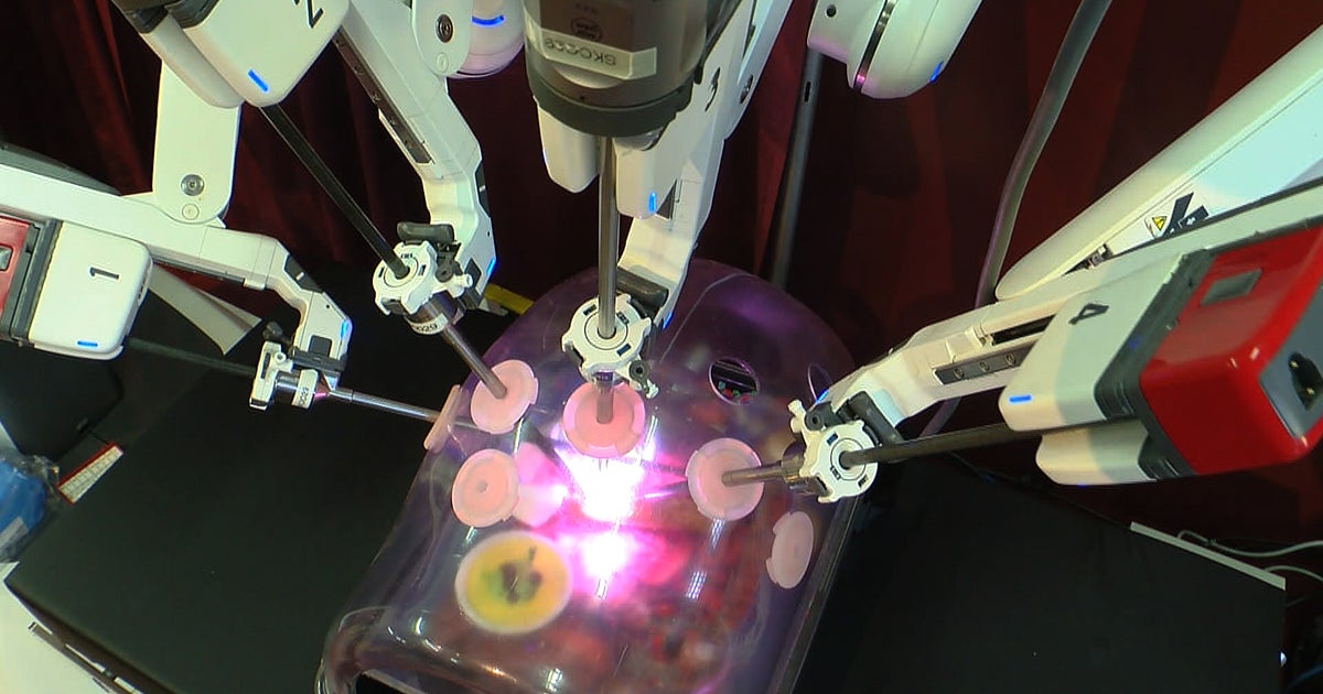 Surgery On A Stick: U of M Showcases New Technology At State Fair - CBS ...