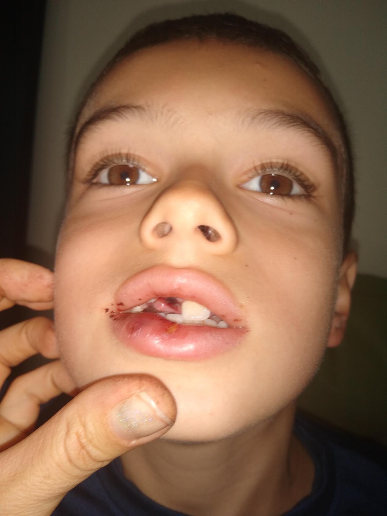 Exclusive: Homeless Man Attacks Autistic 7-Year-Old, Knocks Out Boy's ...