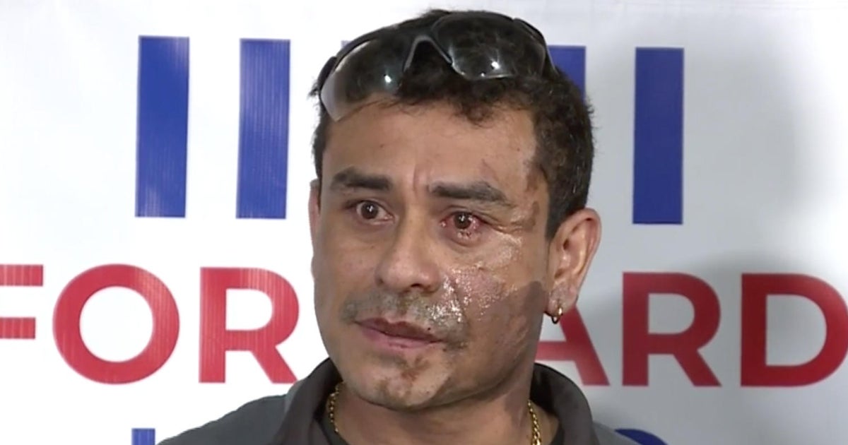 Milwaukee acid attack: Suspect in custody after Hispanic man attacked ...