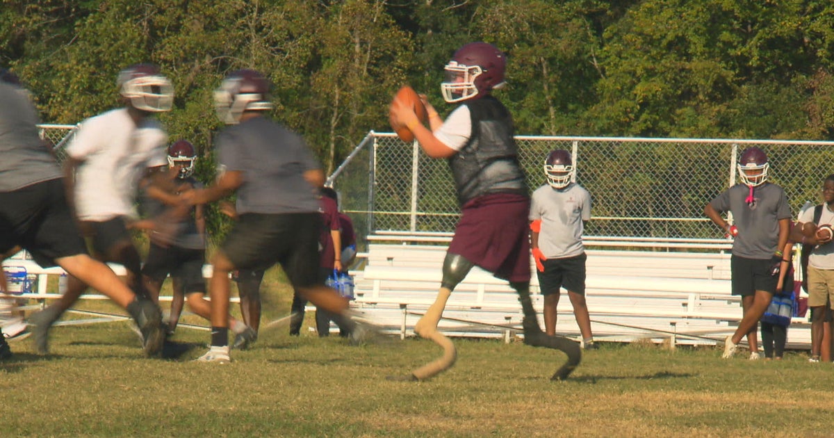 14-year-old double amputee pursues his dreams on the football field ...