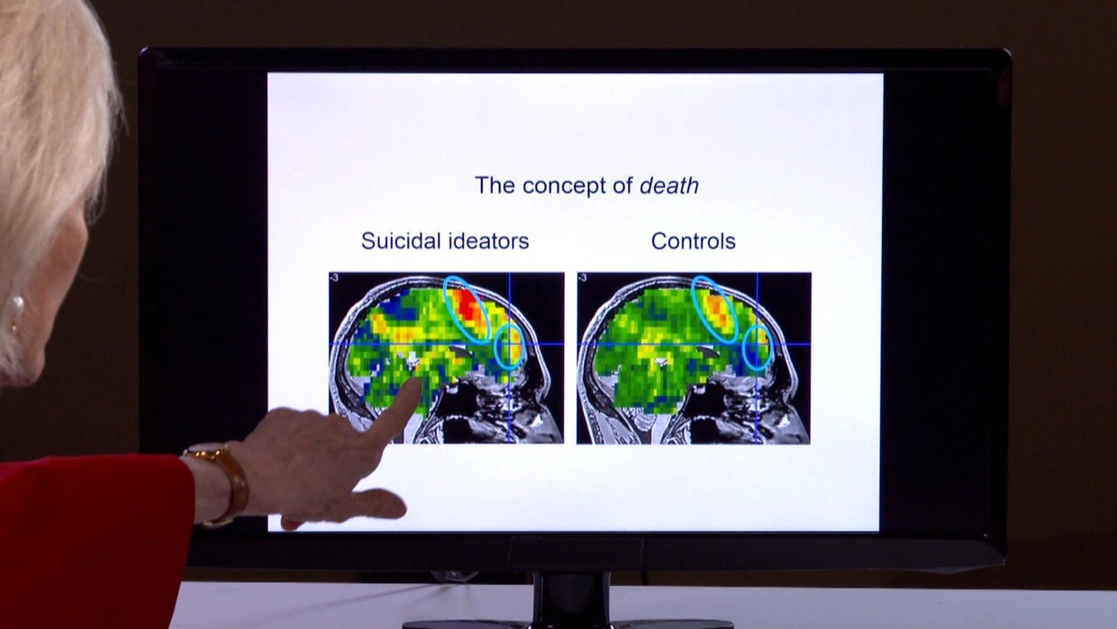 Scientists can use FMRI and computer analysis to read our thoughts - 60 ...