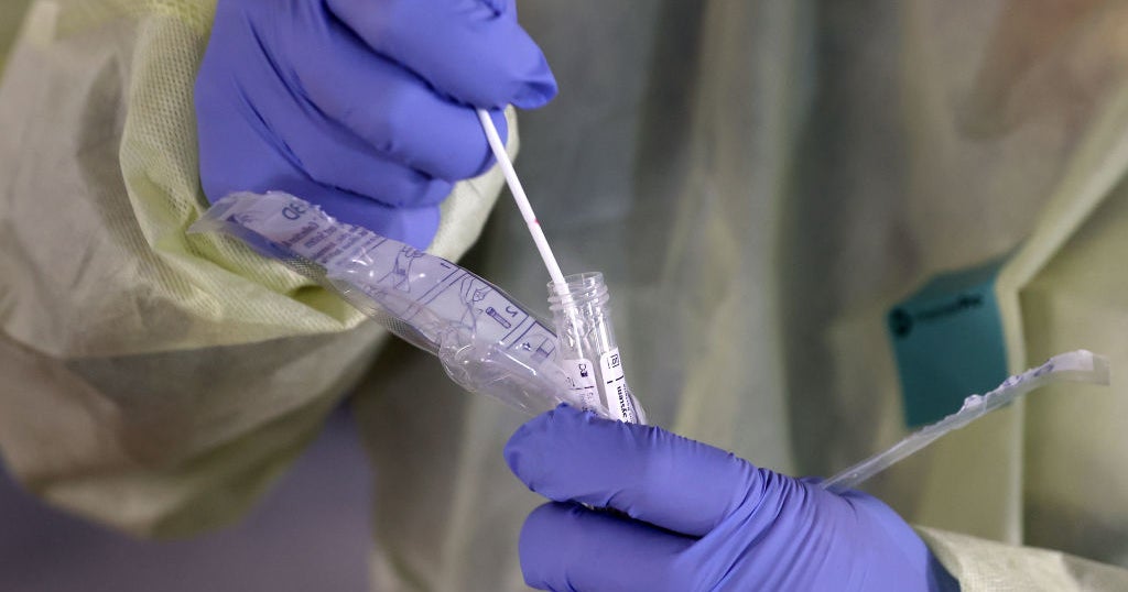 Coronavirus In Minnesota: MDH Reports 924 COVID-19 Cases, 13 Deaths ...