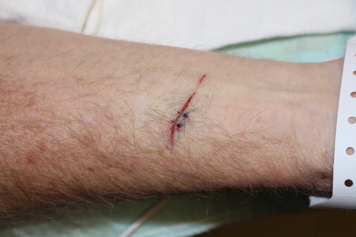 He said, she said: Evidence photos from the Reuschel attempted murder case