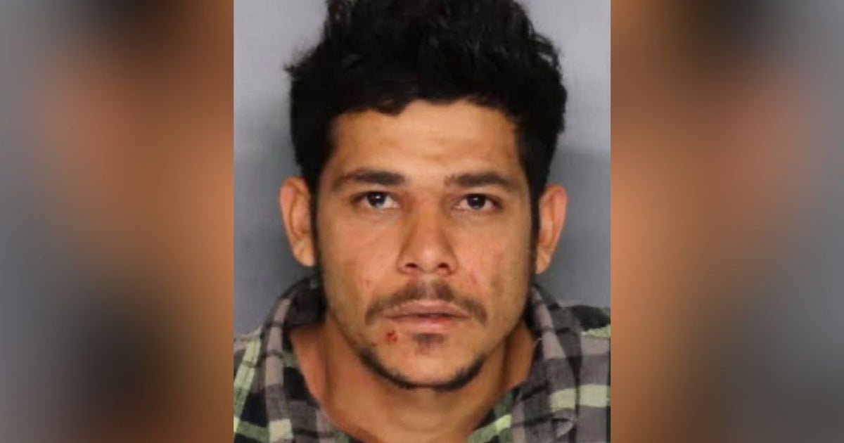 Man Bit Off Piece Of Another Man's Ear During Fight, Stockton Police ...