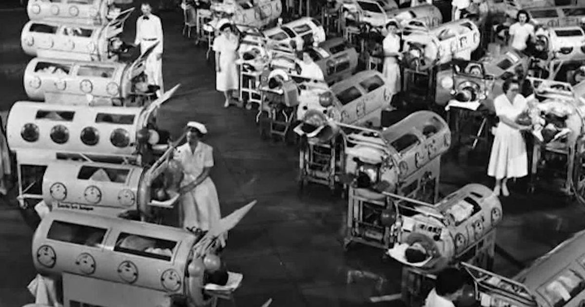 How the fight against polio was won - CBS News