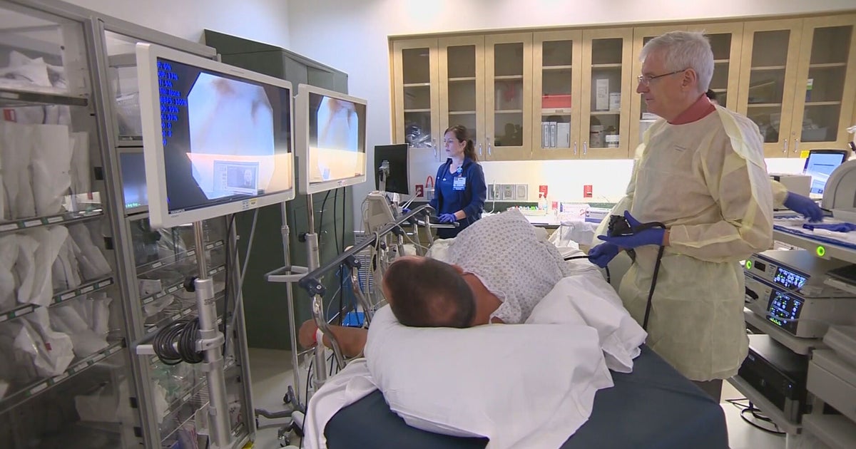 When should you start getting screened for colon cancer? - CBS Boston